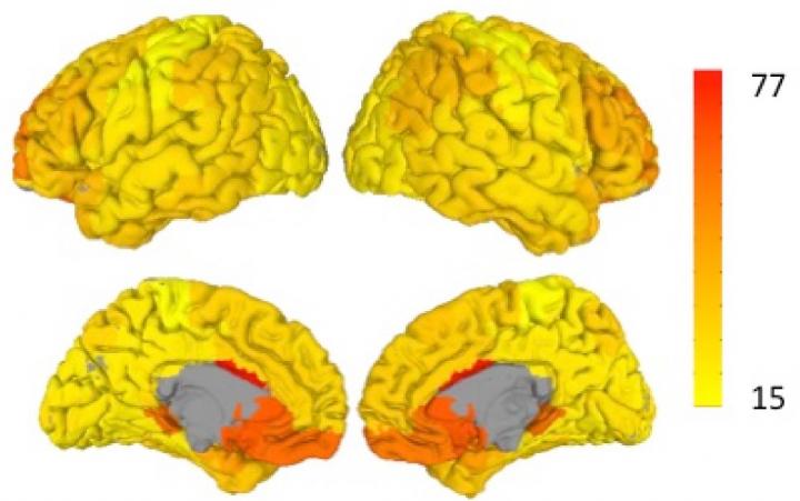 Brain Flexibility Illustration [IMAGE] | EurekAlert! Science News Releases