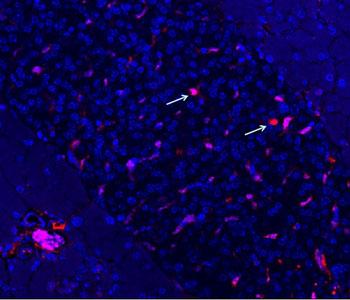 Dying Beta Dells [IMAGE] | EurekAlert! Science News Releases