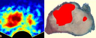 Prostate Images (2 of 2) [IMAGE] | EurekAlert! Science News Releases