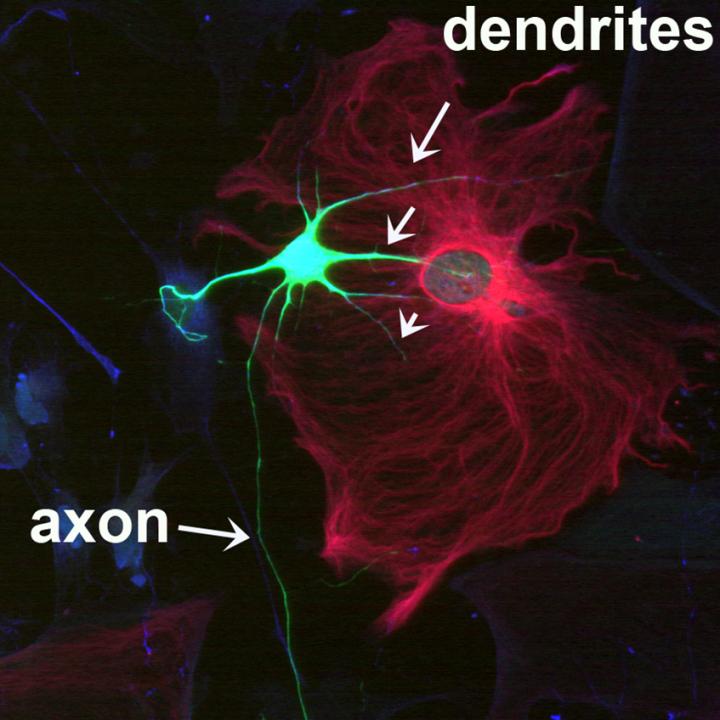 Motor Neuron [IMAGE] | EurekAlert! Science News Releases