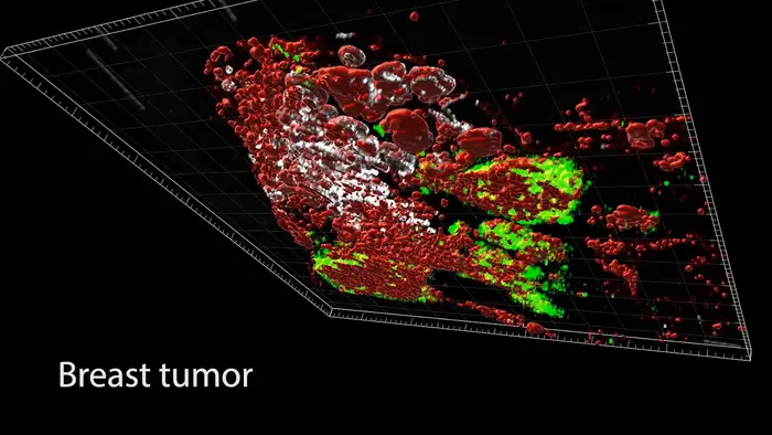 Complexity of tumors revealed in 3D | EurekAlert!