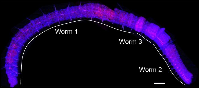Chain of worms [IMAGE] | EurekAlert! Science News Releases