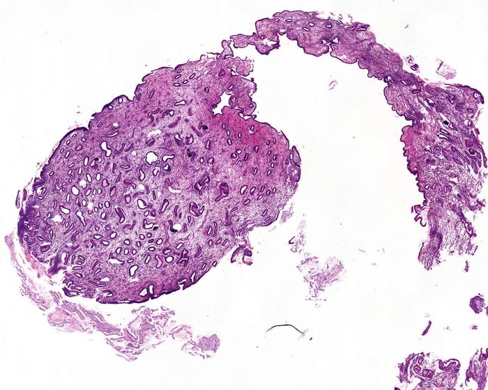 A hystological image of uterus [IMAGE] | EurekAlert! Science News Releases