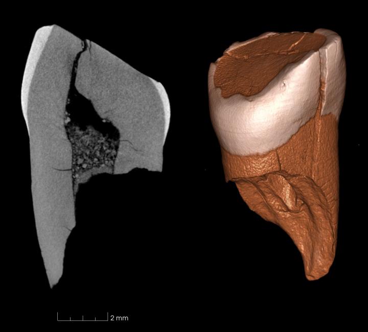 Ancient Teeth Inform Humans' Arrival in Europ | EurekAlert!