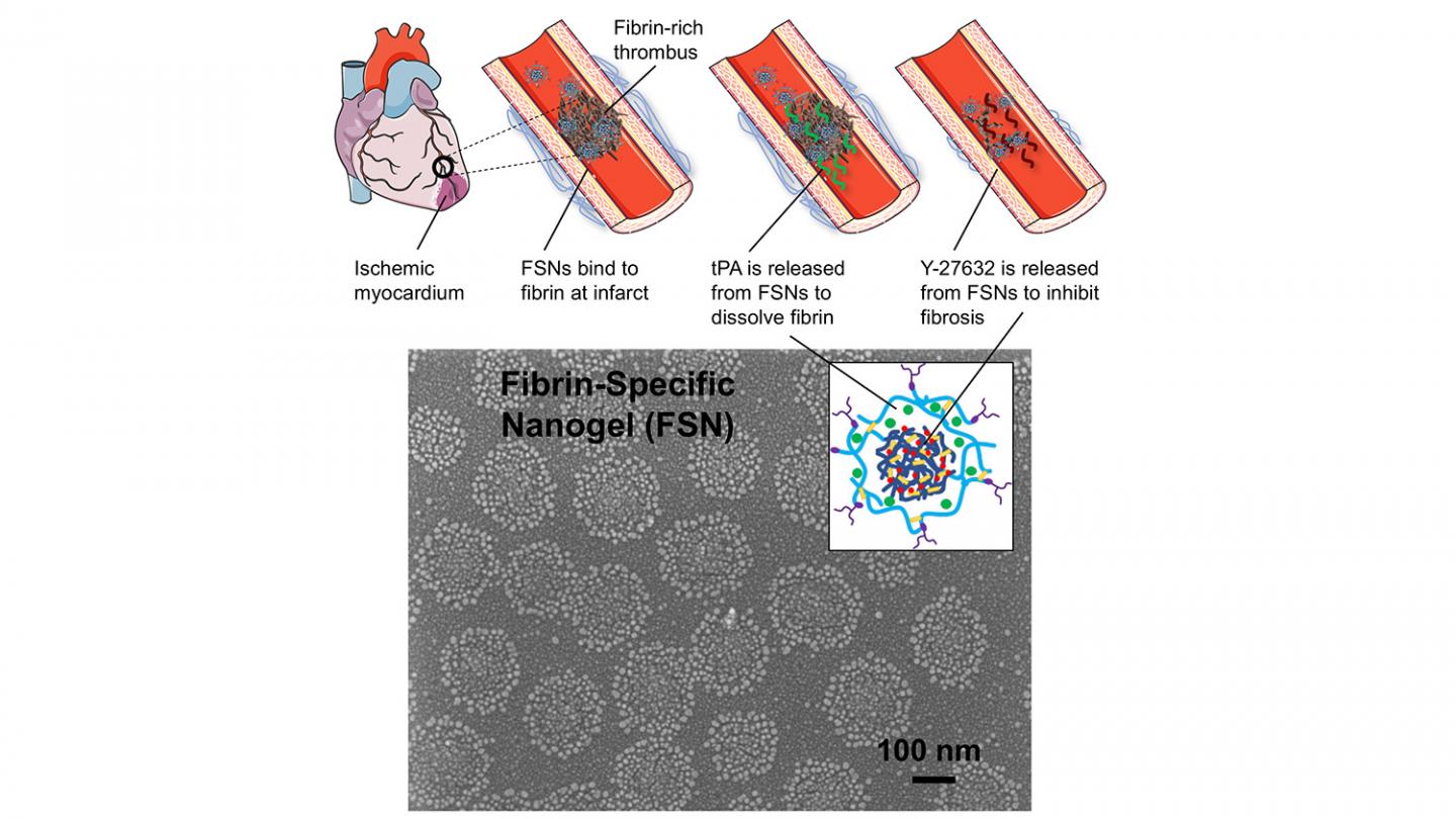 New system allows rapid response to heart att | EurekAlert!