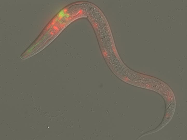 C. Elegans Under A Microscope [IMAGE] | EurekAlert! Science News Releases