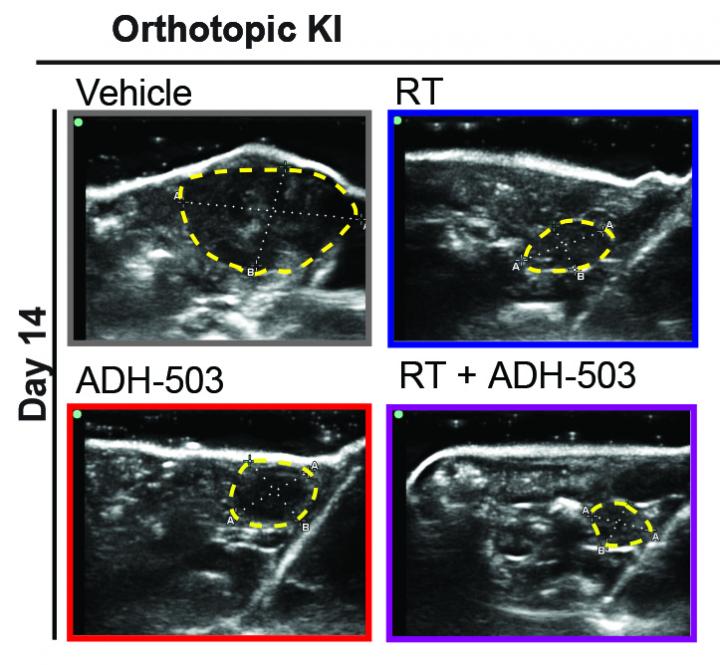 Clearing the Path for More Effective Immunoth | EurekAlert!