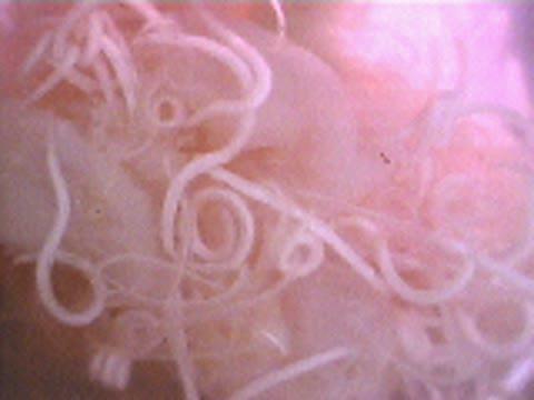 Parasitic worms need their intestinal microfl | EurekAlert!