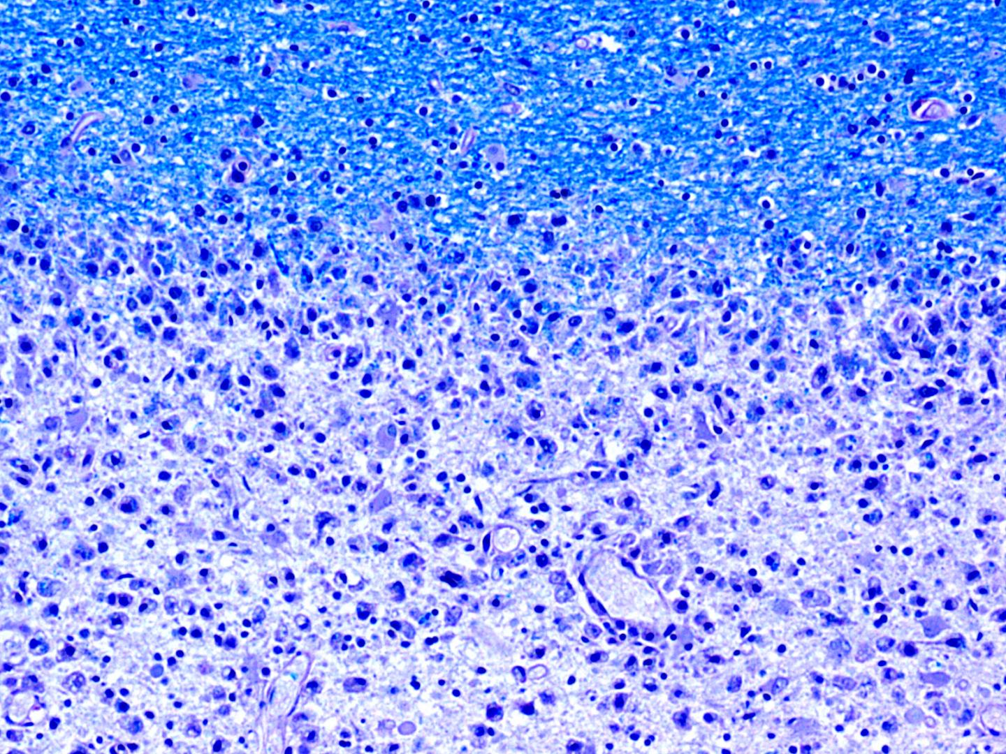 T Cells Target an Enzyme Associated With Gut | EurekAlert!