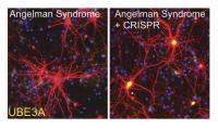 Scientists take major step toward Angelman Sy | EurekAlert!