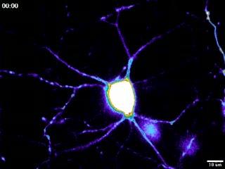 Colorful New Era of Calcium Imaging (2 of 3) | EurekAlert!