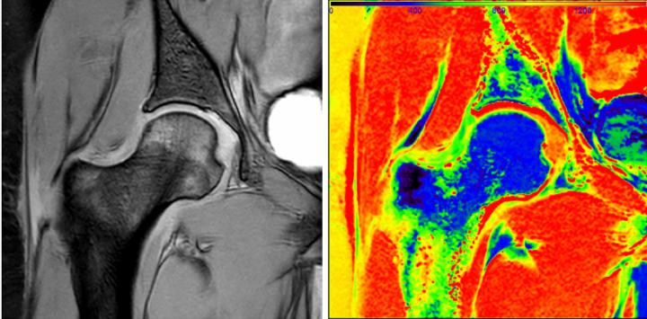 Real-time MRI analysis powered by supercomput | EurekAlert!