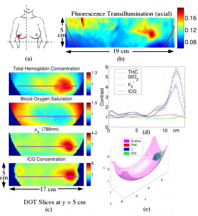 Fluorescence diffuse optical tomography provi | EurekAlert!