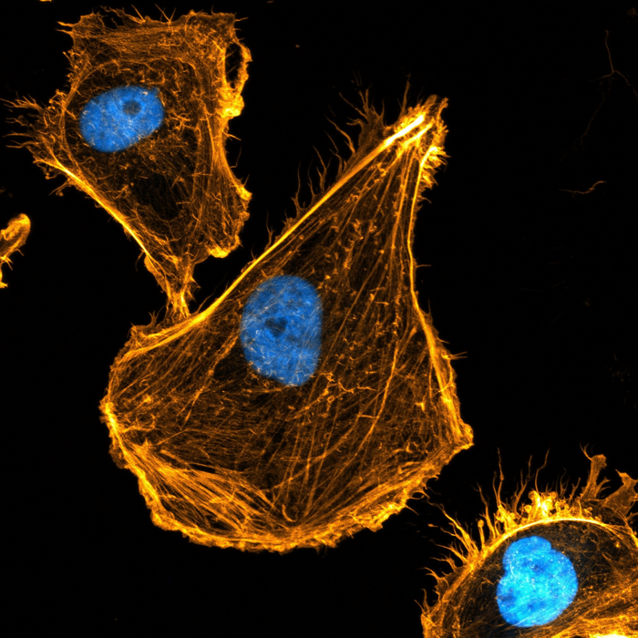 Actine [IMAGE] | EurekAlert! Science News Releases