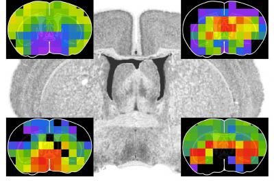 Brain Proteomics in 3-D [IMAGE] | EurekAlert! Science News Releases