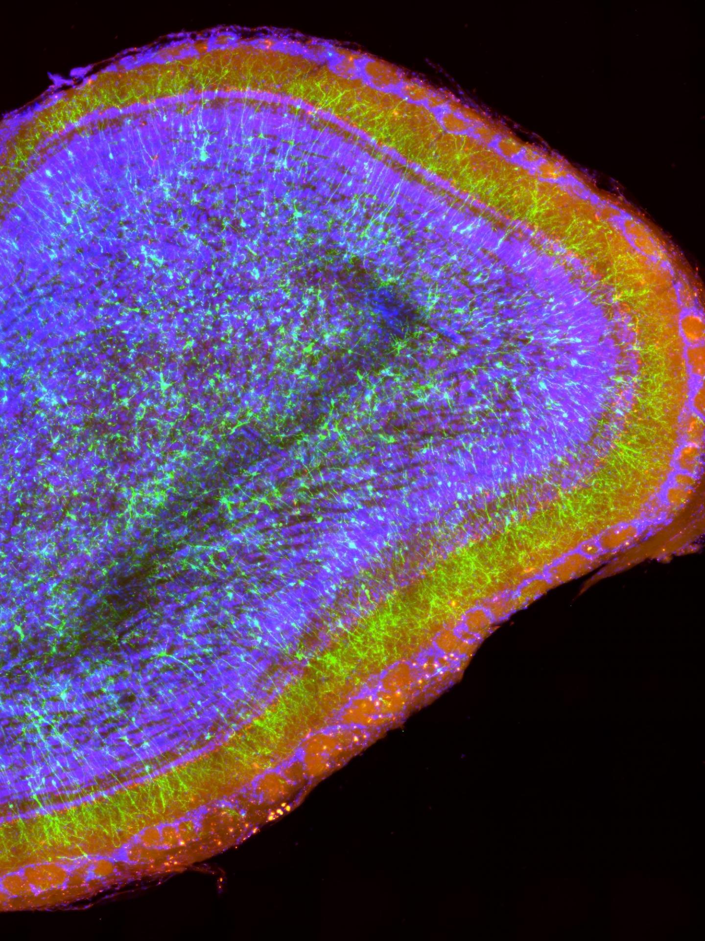 New neurons in the adult brain are involved i | EurekAlert!