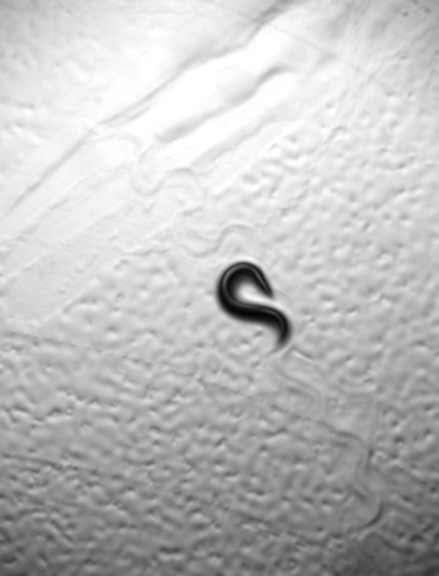 Omega Turn of a Tiny Worm [IMAGE] | EurekAlert! Science News Releases