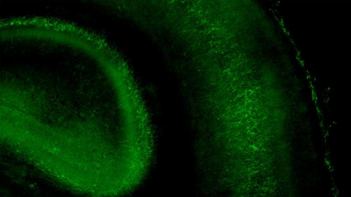 Mouse Somatosensory Cortex [image] Eurekalert Science News Releases