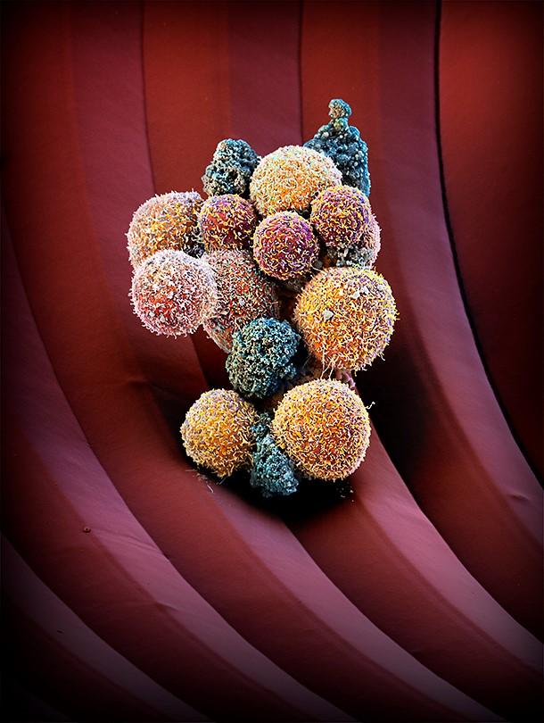 CTC Cluster, Imaged with Elect [IMAGE] | EurekAlert! Science News Releases