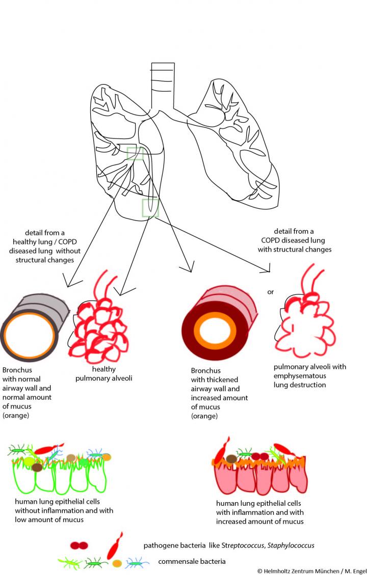 COPD -- changes in the lungs, changes in the | EurekAlert!