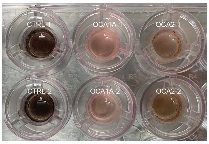 iPSCs stem cell colony [IMAGE] | EurekAlert! Science News Releases