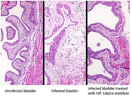 UTI Graph [IMAGE] | EurekAlert! Science News Releases