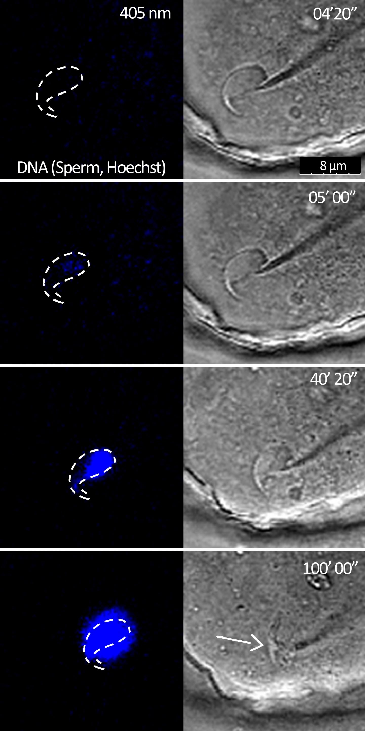 Gamete Fusion and Sperm DNA In [IMAGE] | EurekAlert! Science News Releases