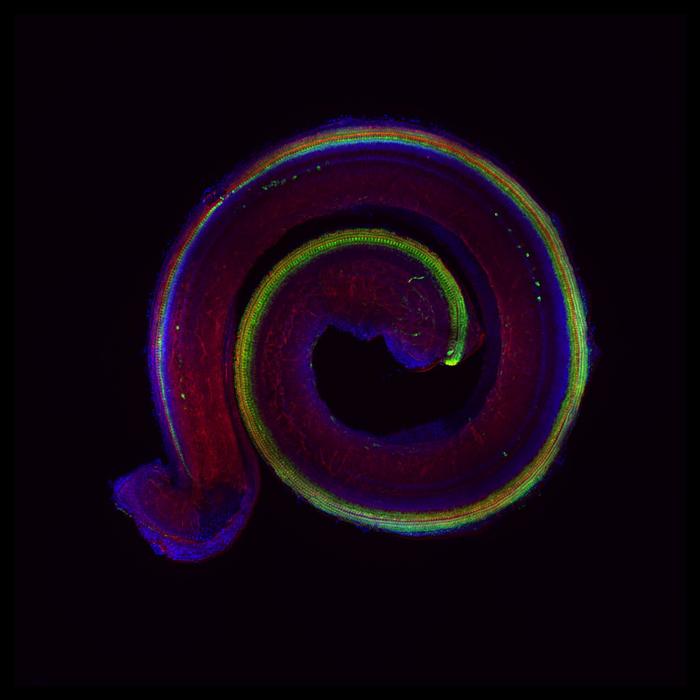 New findings pave the way for hearing loss th | EurekAlert!