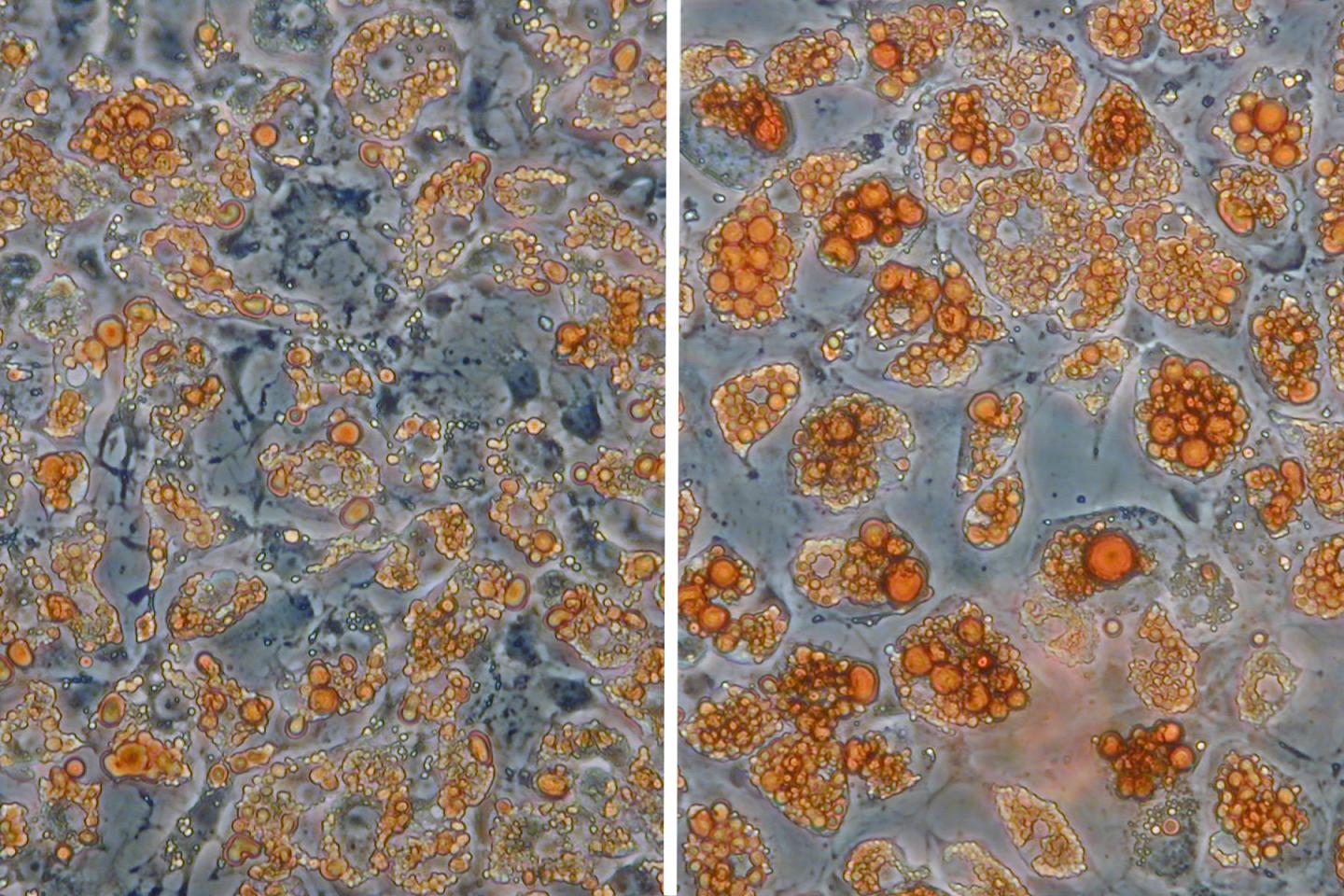 When fat cells change their color | EurekAlert!