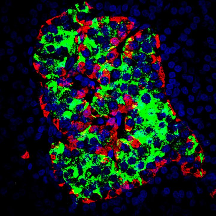 Type 2 diabetes: Understanding regulation of | EurekAlert!