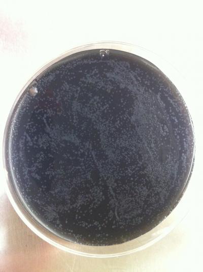 Legionella Colonies [IMAGE] | EurekAlert! Science News Releases