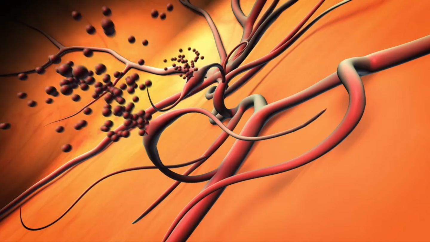 Leaking Blood Vessels [IMAGE] | EurekAlert! Science News Releases