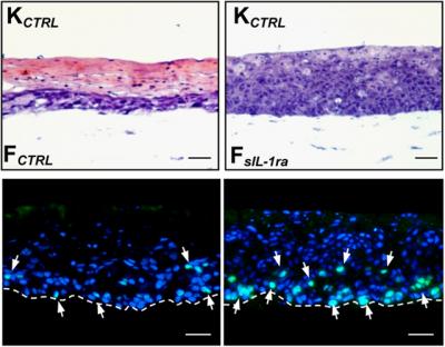 PPAR-beta/delta Modulates Fibr [IMAGE] | EurekAlert! Science News Releases