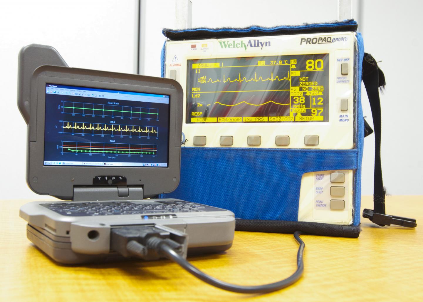 Computerized vital signs analysis may help pr | EurekAlert!