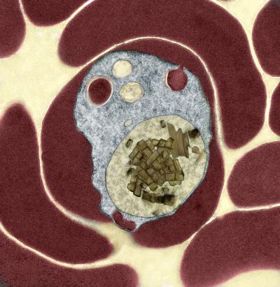 Elusive protein protects malaria parasite fro | EurekAlert!