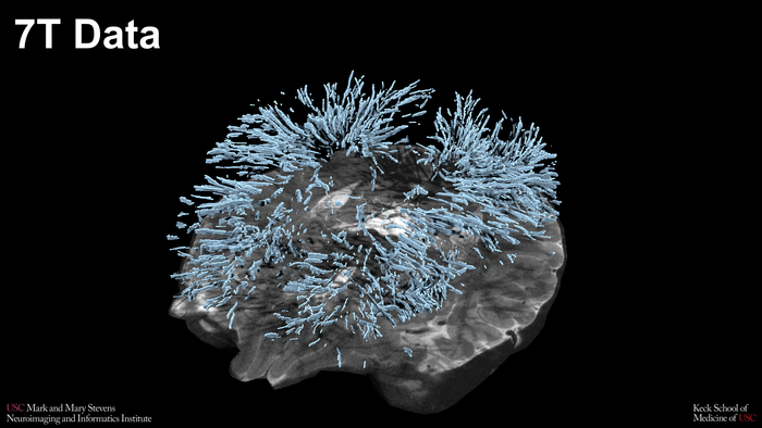 Perivascular spaces [IMAGE] | EurekAlert! Science News Releases
