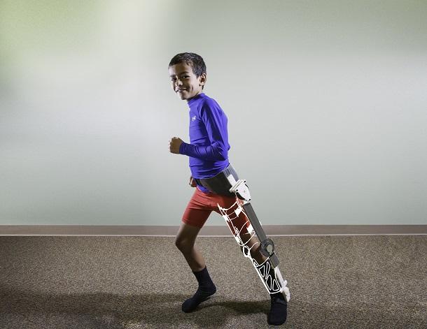 Helping injured children walk, 1 step at a ti | EurekAlert!