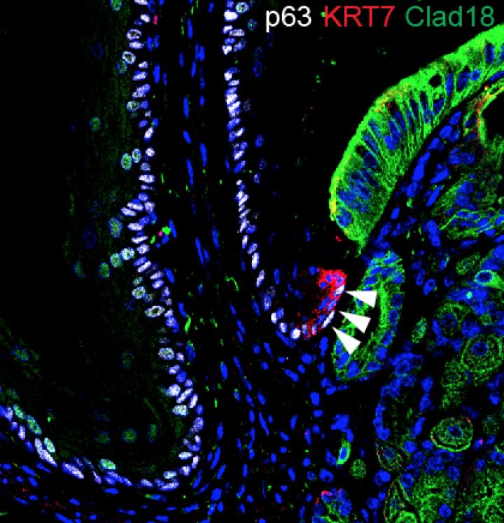 Unique Basal Progenitor Cells [IMAGE] | EurekAlert! Science News Releases