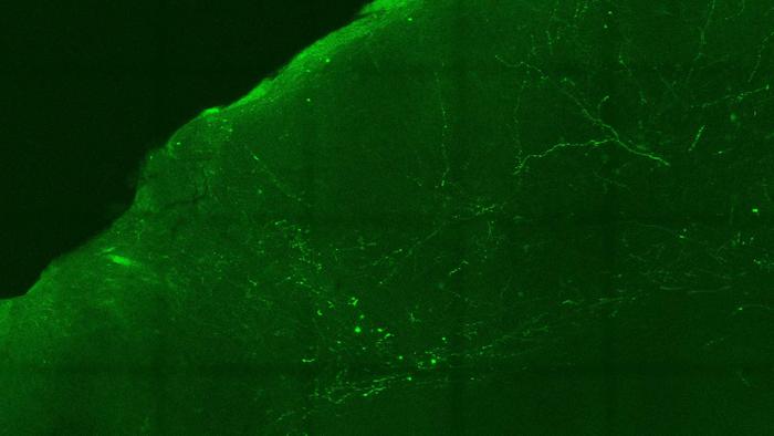 Neural pathways [IMAGE] | EurekAlert! Science News Releases