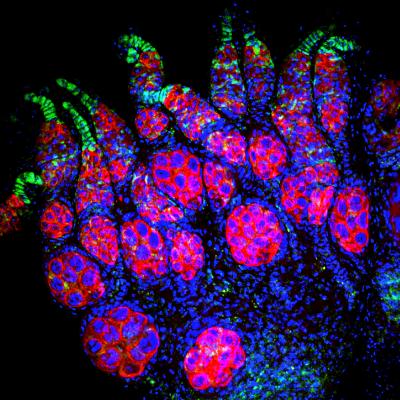 How Wolbachia Helps Female Insects Rep | EurekAlert!