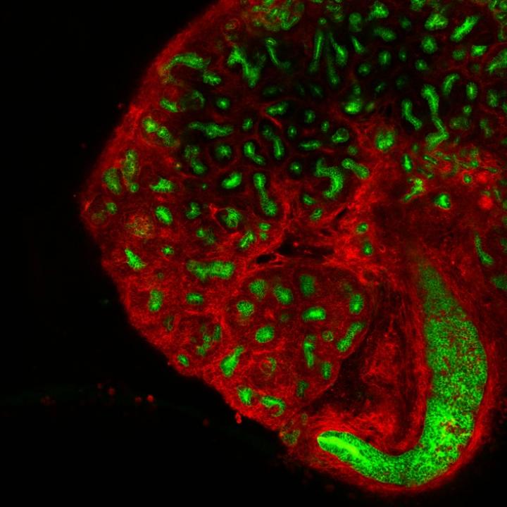 Mouse Embryonic Kidney [IMAGE] | EurekAlert! Science News Releases