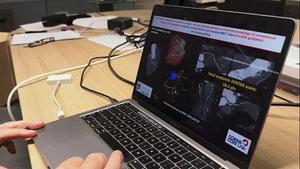 Professor Patrick W Serruys an [IMAGE] | EurekAlert! Science News Releases