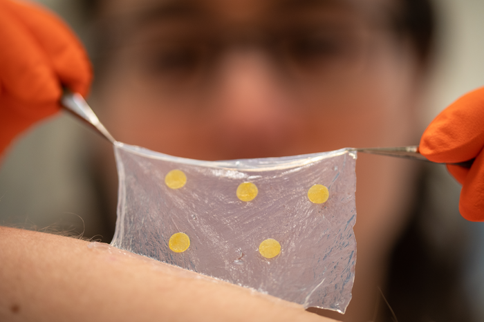 Wound dressing [IMAGE] | EurekAlert! Science News Releases