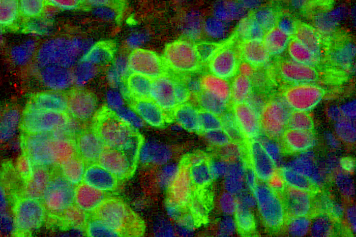 Basal epithelial stem cells in [IMAGE] | EurekAlert! Science News Releases