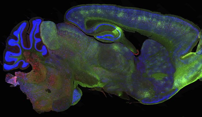 Mouse brain treated with place [IMAGE] | EurekAlert! Science News Releases