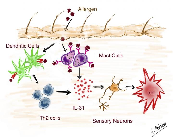 IL-31 as Central Mediator of I [IMAGE] | EurekAlert! Science News Releases