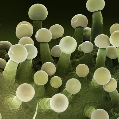 Cannabis sativa trichom [IMAGE] | EurekAlert! Science News Releases