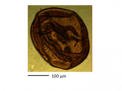 Acritarch Stand-In for Martian [IMAGE] | EurekAlert! Science News Releases