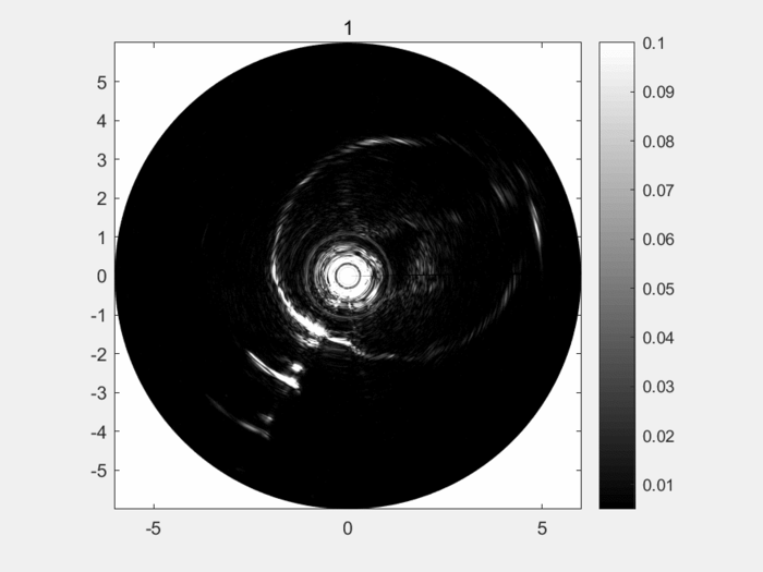 Cross-section of rabbit uterus [IMAGE] | EurekAlert! Science News Releases