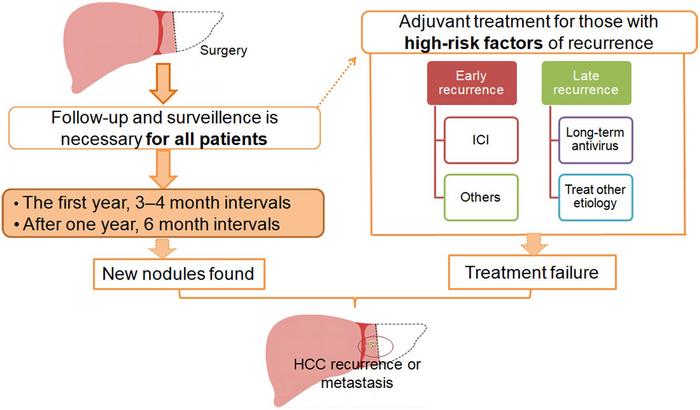 Adjuvant therapy for hepatocellular carcinoma | EurekAlert!